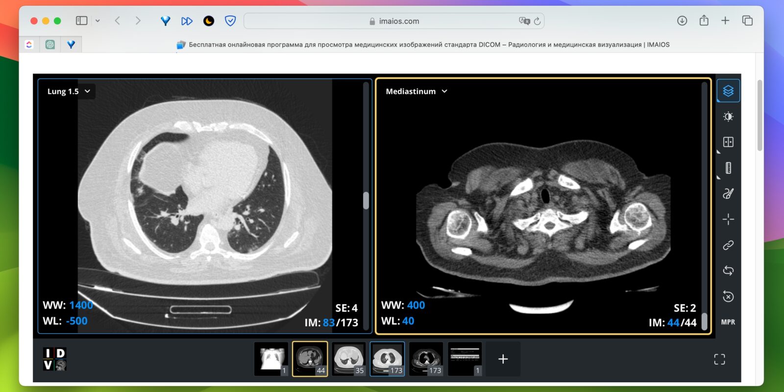 Чем открыть формат DCM — Лайфхакер